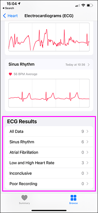 How to Share an ECG from Your Apple Watch with Your Doctor