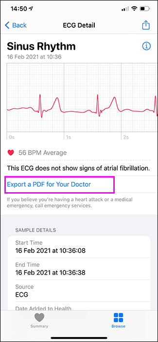 How to Share an ECG from Your Apple Watch with Your Doctor