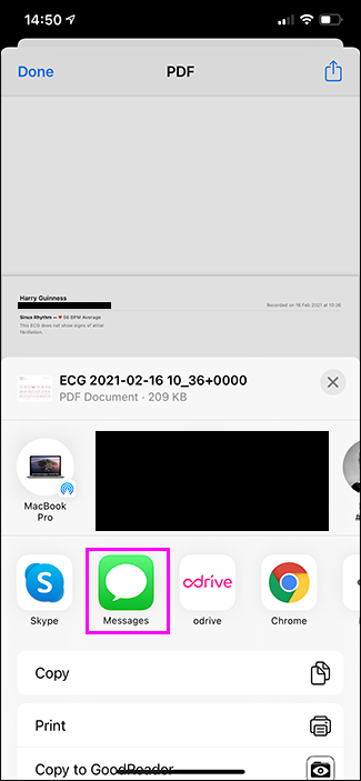 How to Share an ECG from Your Apple Watch with Your Doctor
