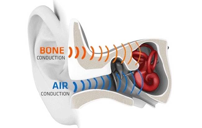 Are Bone Conduction Headphones Still Worth Buying?